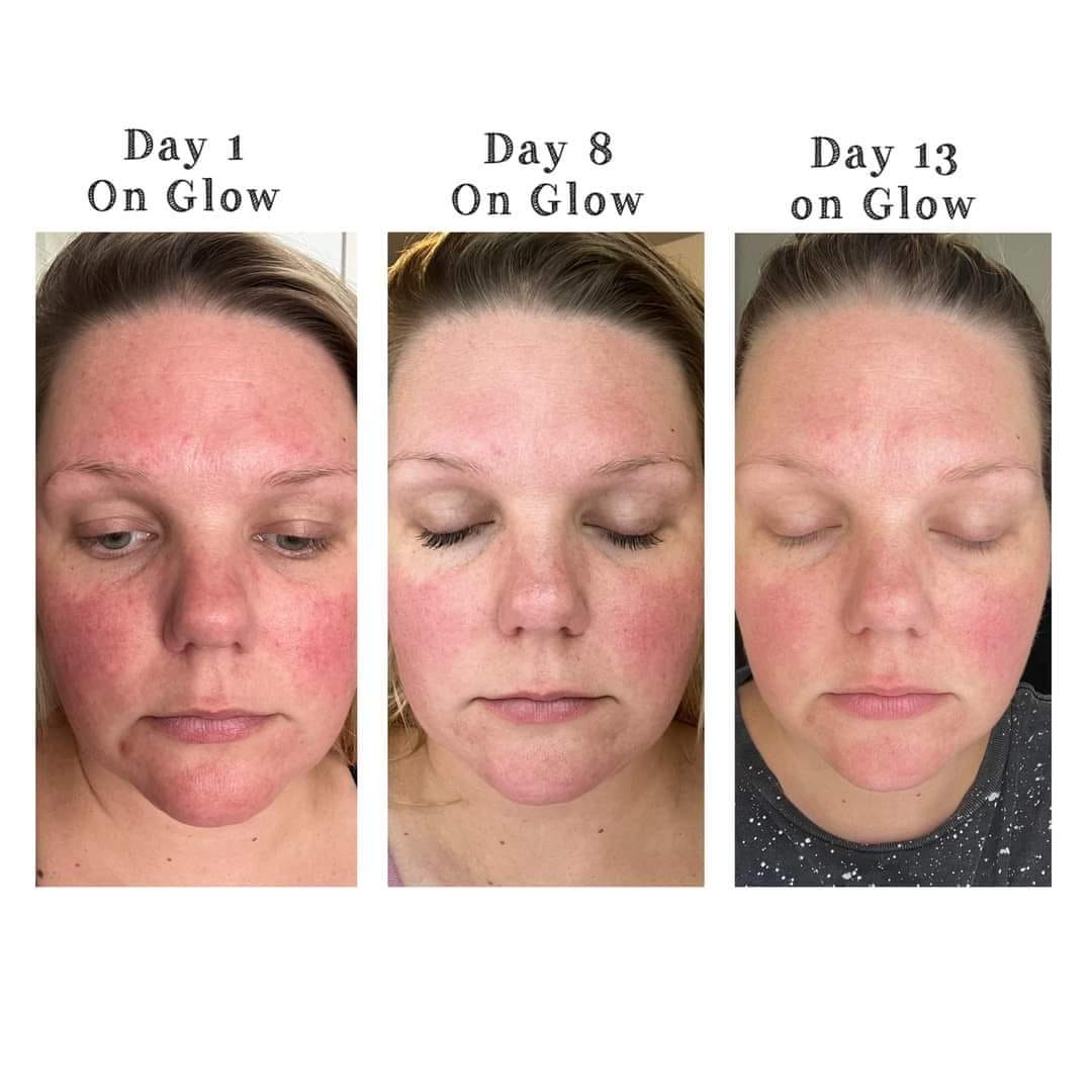 Amanda S – Glow Review – Tranont With Tisha